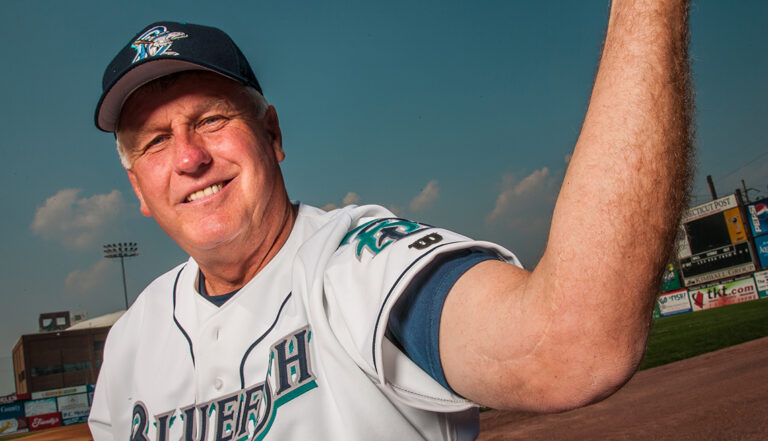 Internal Brace Vs Full Reconstruction- Tommy John Surgery Types